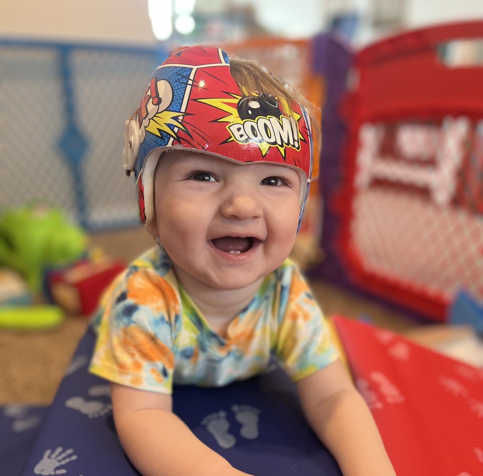 Risks Of Untreated Plagiocephaly Risks Of Untreated Plagiocephaly